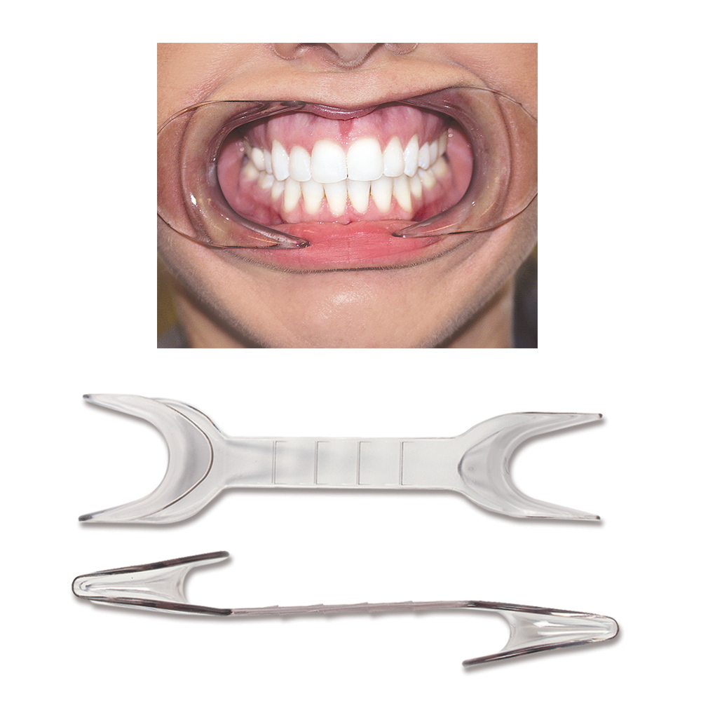 Photo Cheek Retractors Double Ended - Value-Rx, Inc.