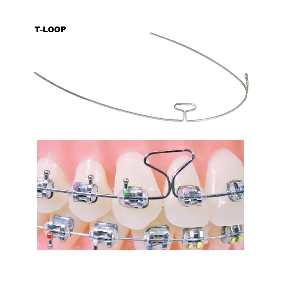 BetaForce™ -Full Form Archwires | Value-Rx, Inc.